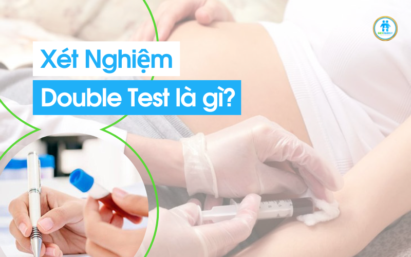 Xét nghiệm Double Test: 10 tip bỏ túi giúp mẹ chuẩn bị trước sinh